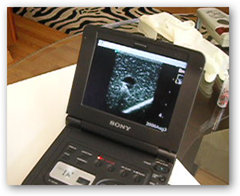 SenoRx Submits Implantable RFID Tags to FDA For Approval – Breast Tumor ...